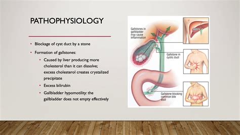 Cholangitis Vs Cholecystitis