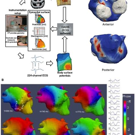 A Block Diagram Of The Electrocardiographic Imaging Ecgi Procedure Download Scientific