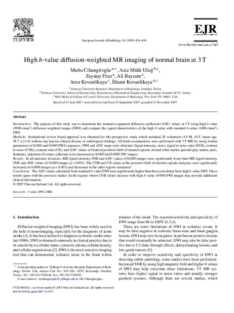 Pdf High B Value Diffusion Weighted Mr Imaging Of Normal Brain At 3 T