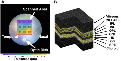 On The Left A The Illustration Of The Scanned Area With Red Border