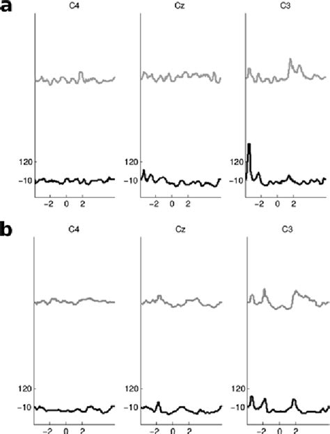 Figure 1 From A MULTI PROPOSAL MOBILE EEG SYSTEM Semantic Scholar