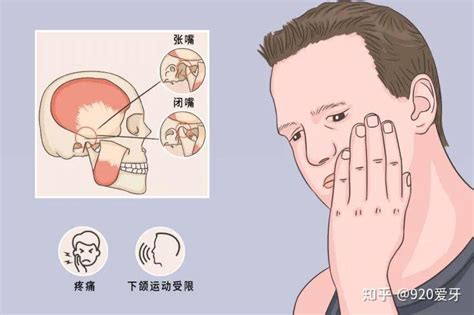 国内口腔颌面外科的发展究竟如何？ 知乎