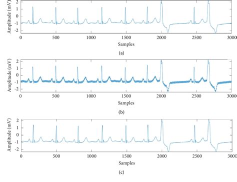 Figure 3 From Empirical Wavelet Transform Based Ecg Signal Filtering Method Semantic Scholar