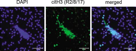 Release Of Nets By Human Neutrophils In Response To Pma Nets Are Download Scientific Diagram