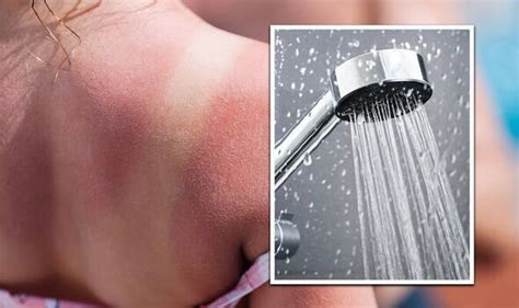 How To Bath And Shower With Sunburn Expert Warns To Never Take A High