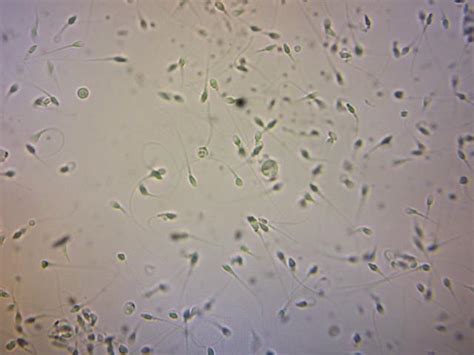 Sperm Masking Instance Segmentation Model By Projects