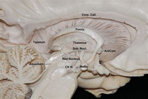 Medial View Of The Left Hemisphere Neuroanatomy The Neurosurgical Atlas