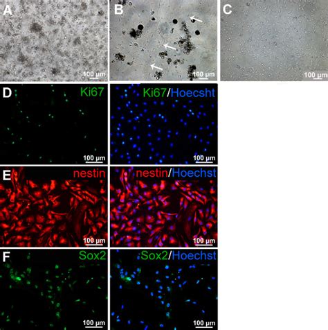 Isolation Of Neural Stem Progenitor Cells From The Periventricular Region Of The Adult Rat And