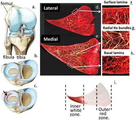 Fibrocartilage Knee