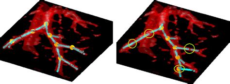 Figure 3 From Bifurcation Detection In 3d Vascular Images Using Novel Features And Random Forest