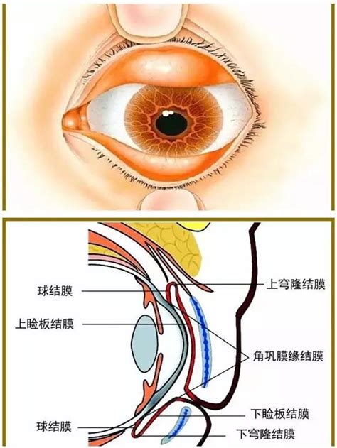 眼结膜位置 症状 膜 第8页 大山谷图库