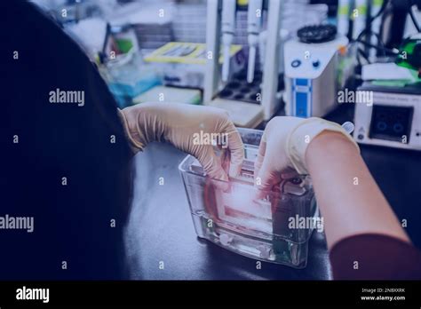 Western Blot Analysis Use As Protein Analysis For Protein Detection This Technique Use In