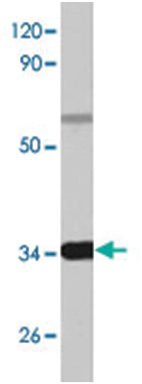 Anti Cebpb Antibody 100ul