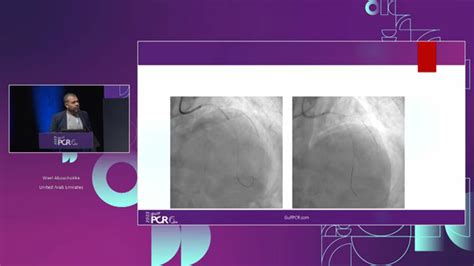 Challenging Scenarios In Stemi Patients