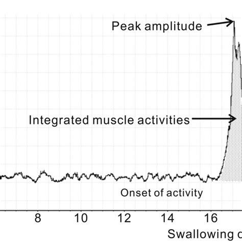 Representative Surface Electromyography Output Showing How Values For Download Scientific