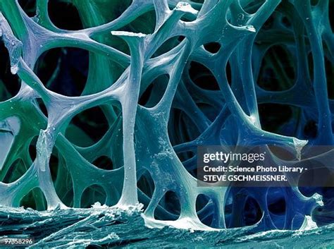 Scanning Electron Micrograph Photos And Premium High Res Pictures Getty Images
