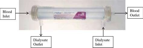 Figure 11 From Study Of Dialyzer Membrane Polyflux 210h And Effects