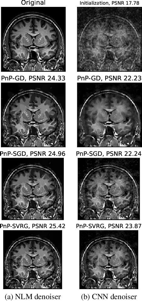 Figure 1 From Plug And Play Image Reconstruction Meets Stochastic Variance Reduced Gradient