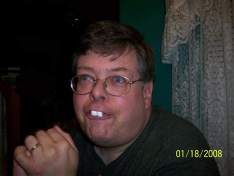 Chiclet Teeth Look Stupid You Look Stupid