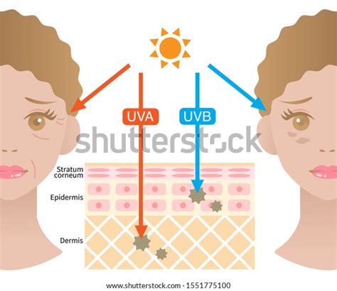 Infographic Illustration Difference Between Uva Uvb Stock Vector Royalty Free 1551775100