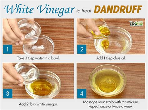 Home Remedies For Dandruff Top 10 Home Remedies