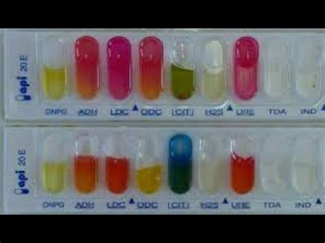 La Galerie API Analytical Profile Index YouTube