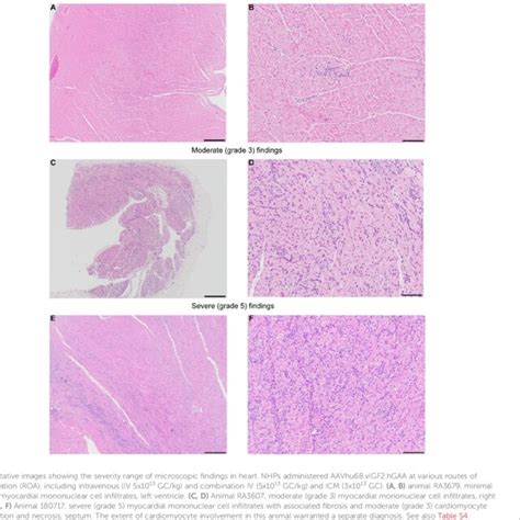 Elispot Response Epitope Mapping In Liver Lymphocytes Download Scientific Diagram