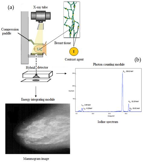 Hybrid Detection Of Breast Abnormalities Based On Contrast Agents Introducing A Proof Of