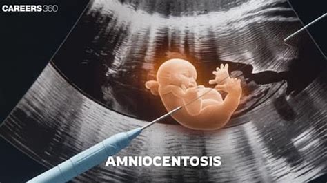 Amniocentesis Purpose Procedure Risks Recovery Benefits