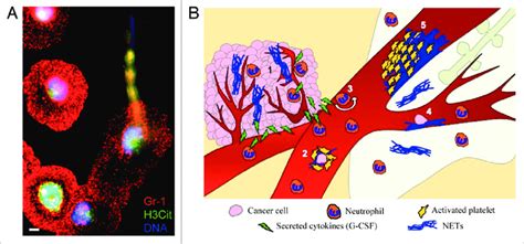 Tumor Induced Neutrophils Are More Sensitive To Net Formation And Nets