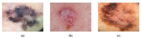 Algorithms Free Full Text Machine Learning Approaches For Skin