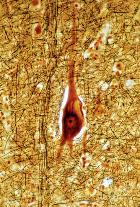 Lipofuscin In Pyramidal Neuron By Science Photo Library
