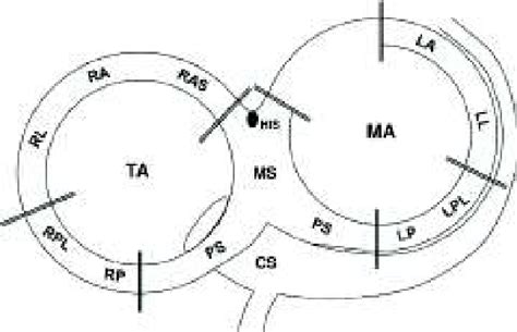 Different Location Of Accessory Pathway Download Scientific Diagram