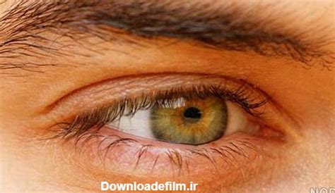 عکس چشم میشی