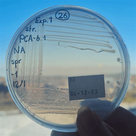 Question About Pseudomonas Spp R Microbiology