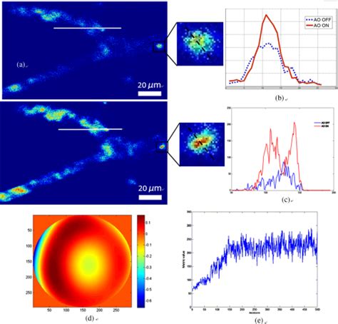 Aberration Correction During Real Time In Vivo Imaging Of Bone Marrow