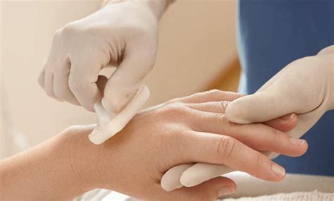 Bd Chloraprep Frepp Applicators Applicator Chloraprep Frepp 1 5ml — Grayline Medical