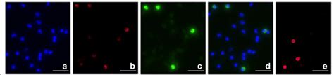 Single Ctcs Detected After Enrichment Using Spiral Microfluidics
