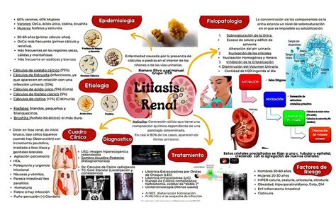Litiasis Renal Udocz