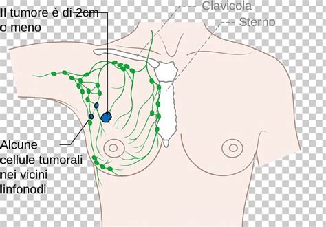 Axilla Lymph Node Arm Diagram PNG Clipart Abdomen Anatomy Angle Arm Axilla Free PNG Download