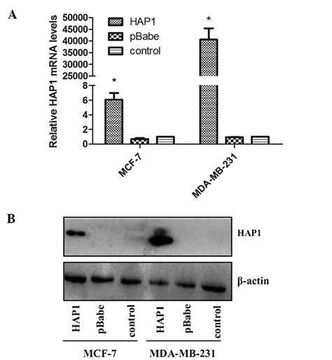 Huntingtin Associated Protein A Potential Biomarker Of Breast Cancer