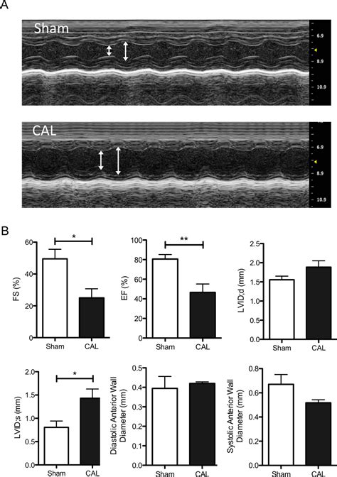 Myocardial Infarction In Neonatal Mice A Model Of Cardiac Regeneration