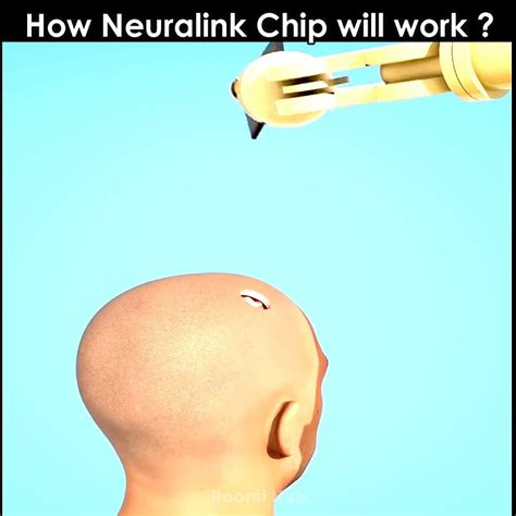 How Neuralink Chip Will Work Youtube