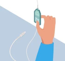 A Complete Step By Step Guide To Administering Tpn At Home