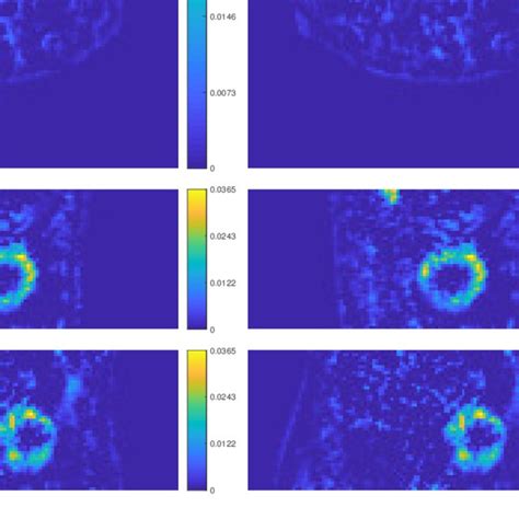 Comparison Of The Standard Patlak Plot And Relative Patlak Plot In The Download Scientific