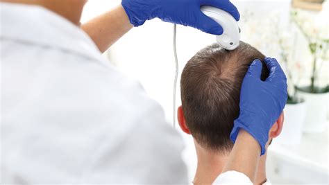 Katrina Horman Trichology Clinic Jersey Scalp Problems