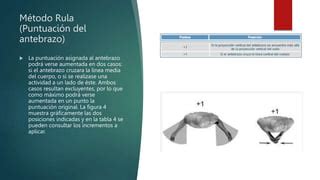 Método Rula Ergonomia Posturas Del Cuerpo Brazo Torso Y Cintura Pptx