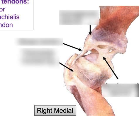 Glenohumeral Joint Diagram Quizlet