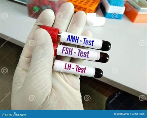Blood Samples Tube With Sample For AMH FSH And LH Test Stock Photo Image Of Syphilis