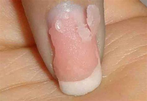 How Do You Take Off Acrylic Nails Using Acetone
